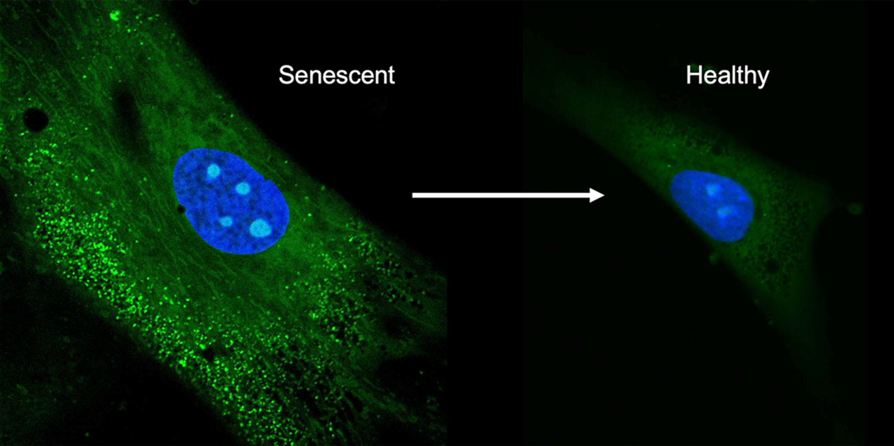 New drug delivery method can reverse senescence of stem cells | Carl R ...