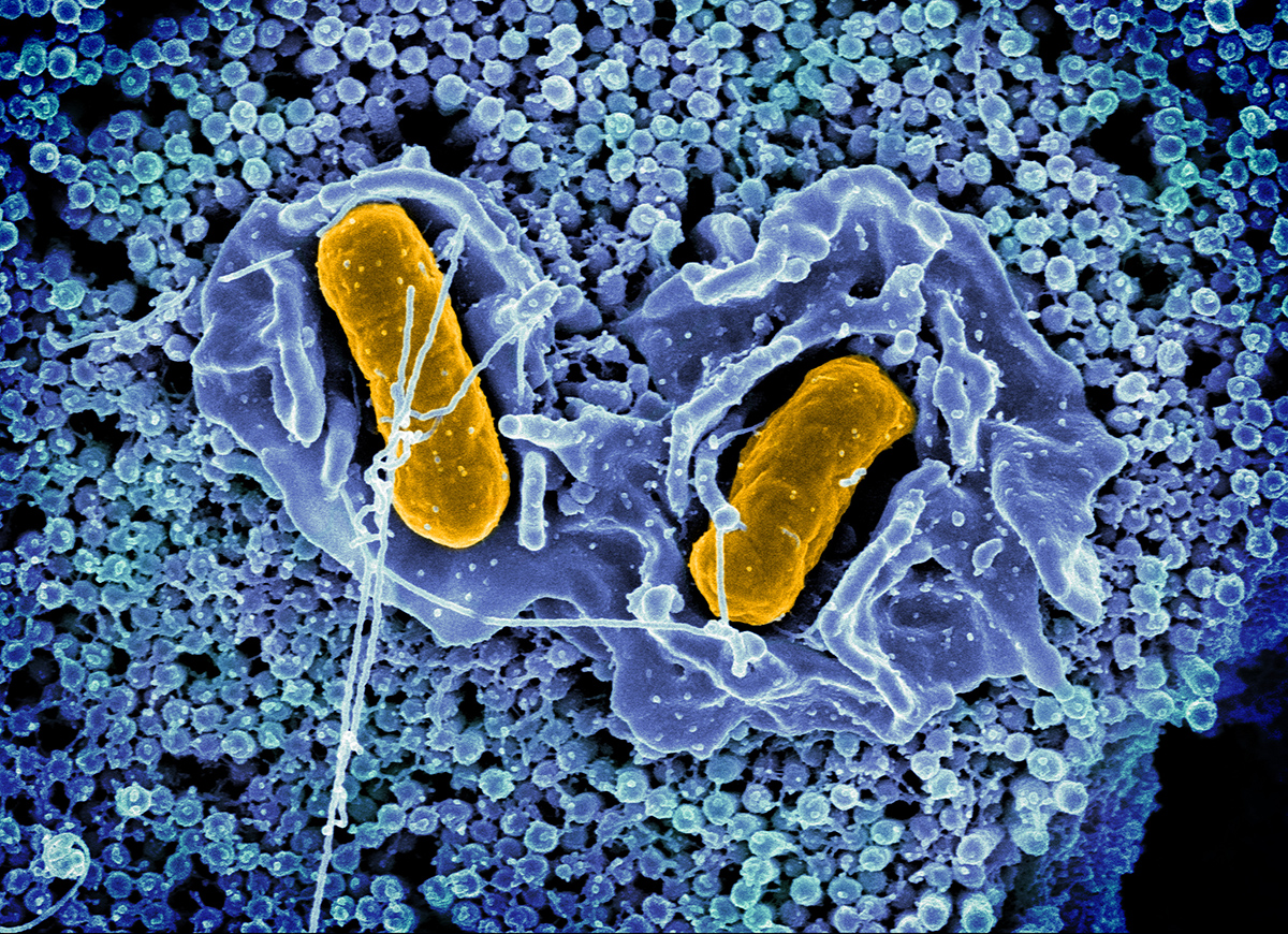 New insights into what helps Salmonella cause infections | Carl R ...